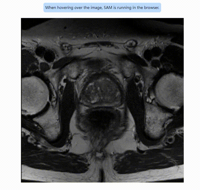 Segment Anything CV界的GPT—prompt-based里程碑式研究成果_promptable model-CSDN博客