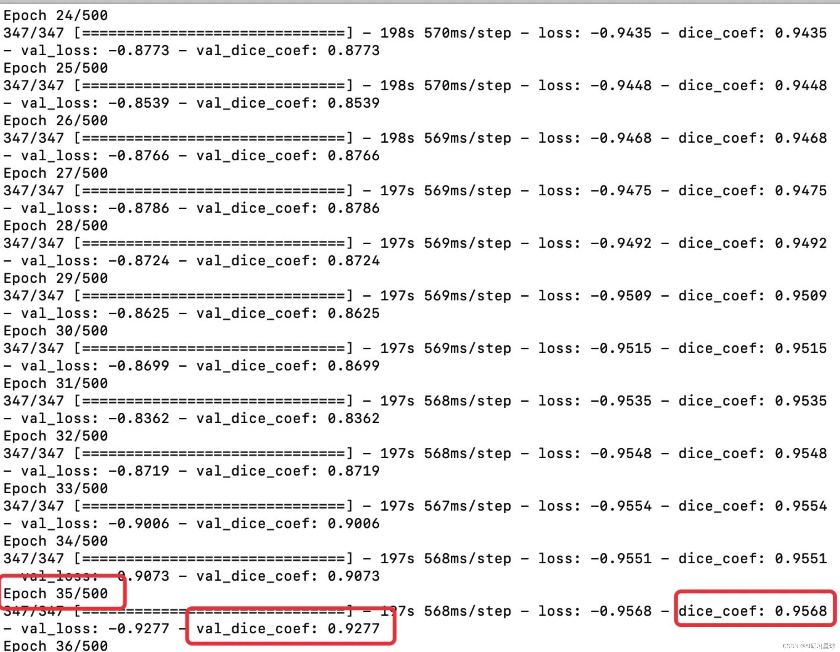 计算机视觉-02-基于U-Net的肝脏肿瘤分割（包含数据和代码）_vnet 3d肝脏分割代码-CSDN博客