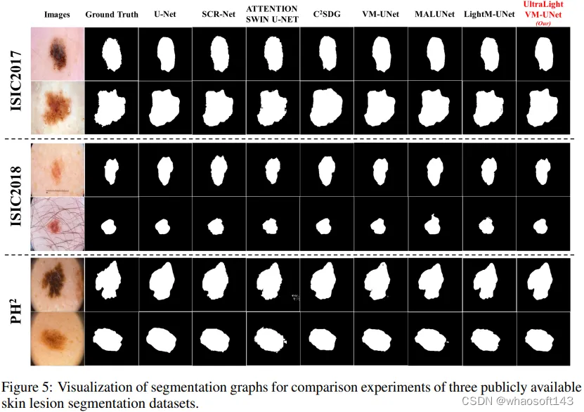 UltraLight-VM-UNet_ultralight vm-unet-CSDN博客