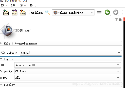 超级简单的3D slicer教程（三）creating label Map_3d slicer roi删除-CSDN博客