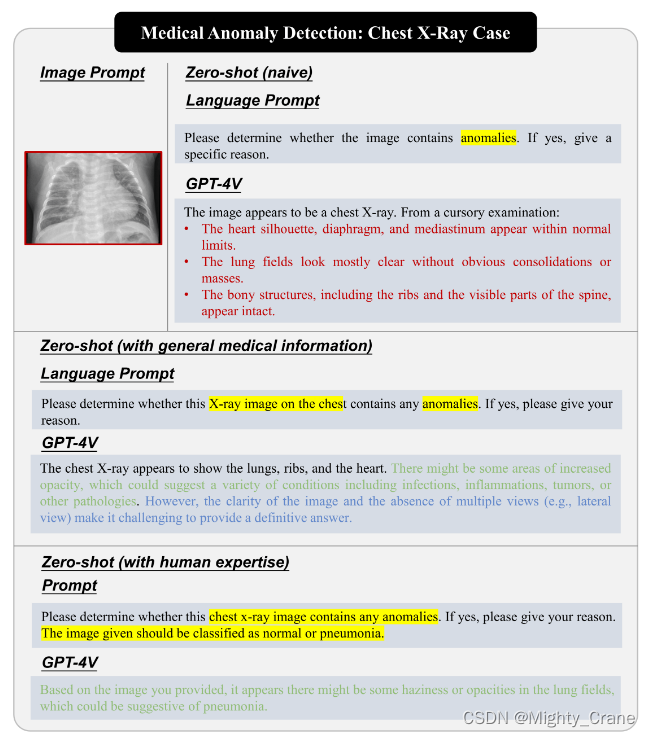 读《Towards Generic Anomaly Detection and Understanding: Large-scale Visual-linguistic Model (GPT ...