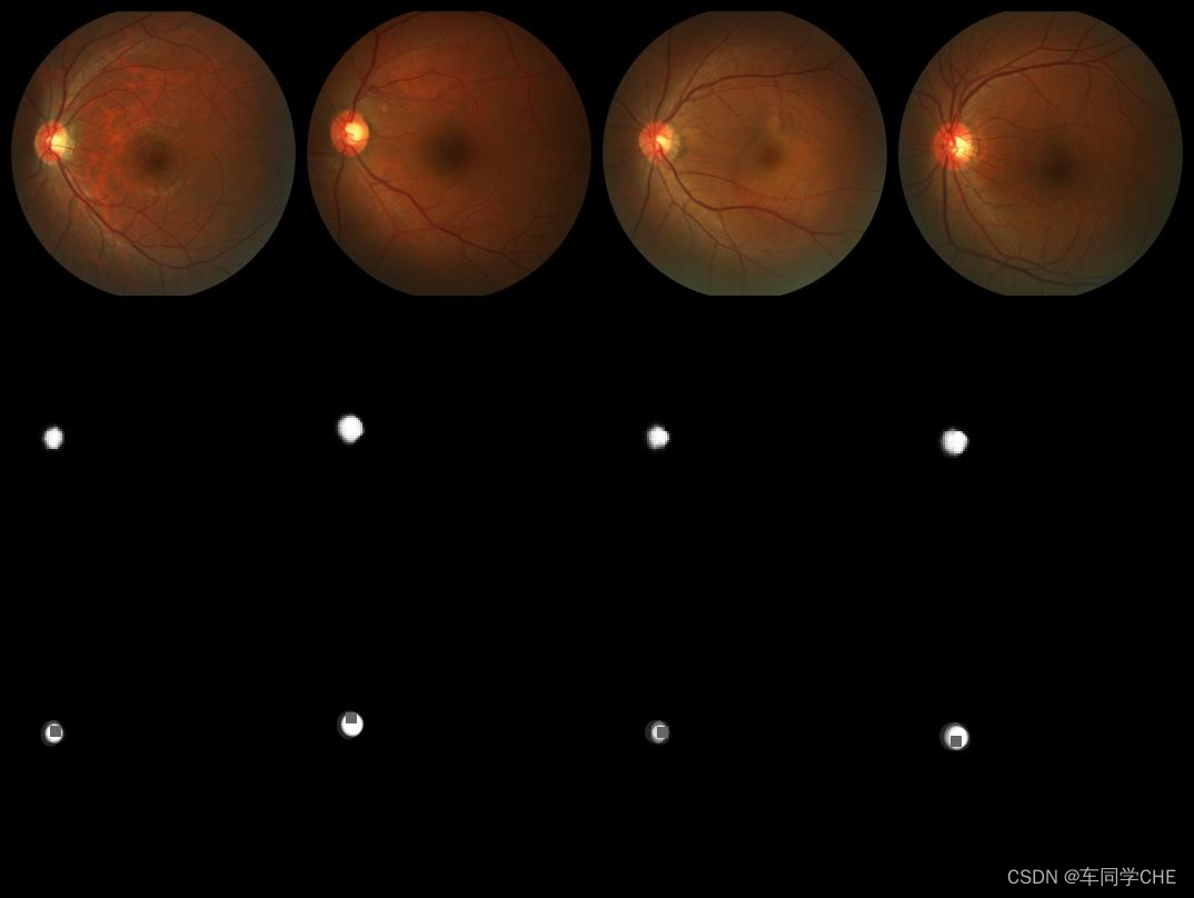 论文代码复现之Medical SAM Adapter (Junde Wu version)_raise runtimeerror(f ...