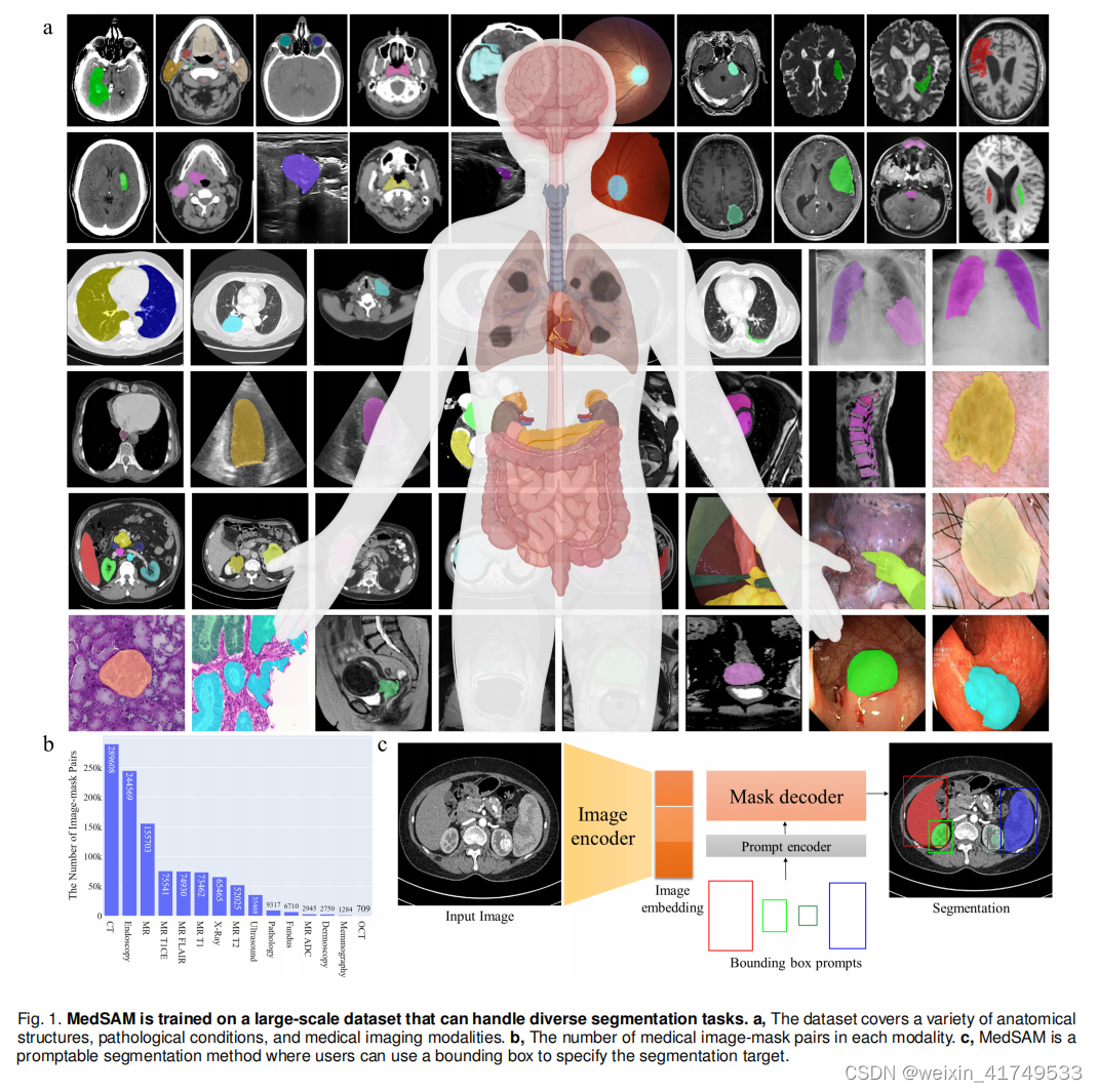 Segment Anything in Medical Images-CSDN博客