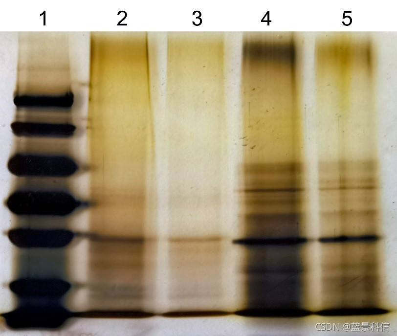 筛选鉴定与已经基因启动子相互作用的DNA结合蛋白-DNA Pull Down实验原理，技术流程_dnapulldown探针一般多长-CSDN博客