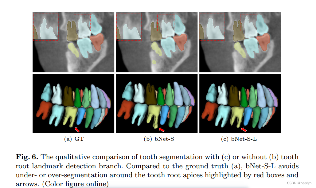 Hierarchical Morphology-Guided Tooth Instance Segmentation from CBCT Images-CSDN博客