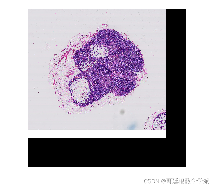 Matlab环境下基于图像处理的计算病理学图像分割(matlab R2021b)matlab Blockedimage Csdn博客