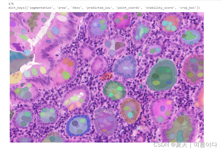 CV | Segment Anything论文详解及代码实现-CSDN博客