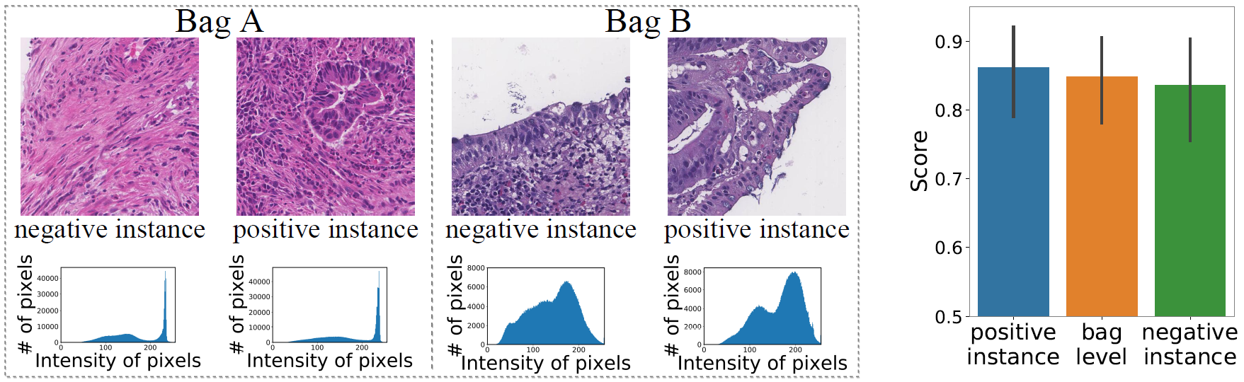 论文阅读 (45)：Interventional Multi-Instance Learning with Deconfounded Instance-Level Prediction-CSDN博客