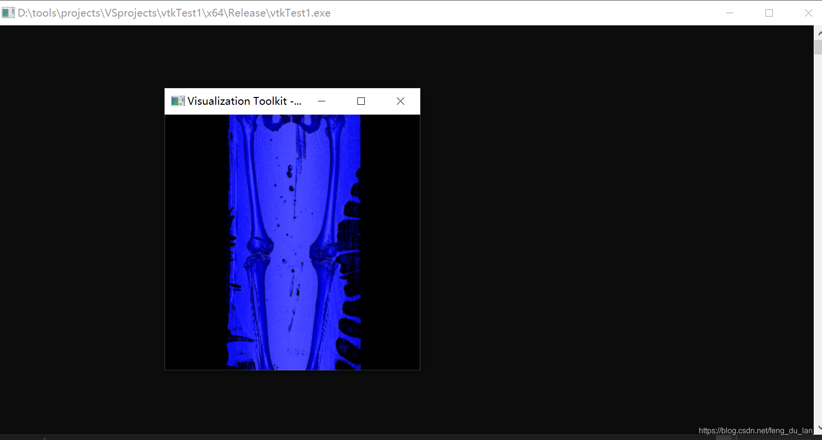 VTK读取dicom序列，并保存成vtk和obj格式的3D格式文件_vtk读取序列dicom-CSDN博客