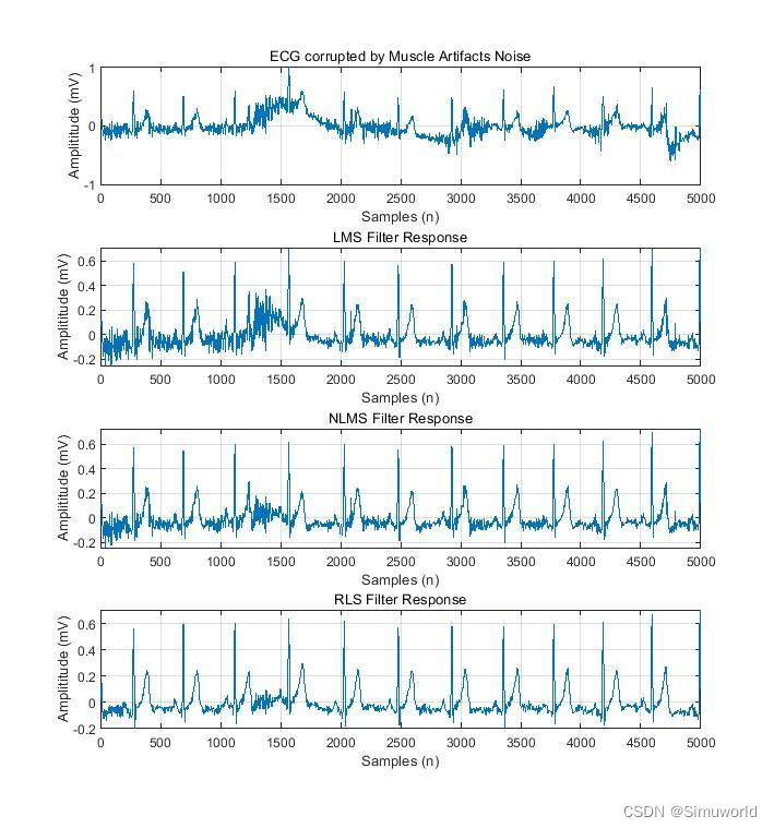 ECG信号的自适应滤波matlab仿真,对比LMS和RLS_ecg信号rls滤波-CSDN博客