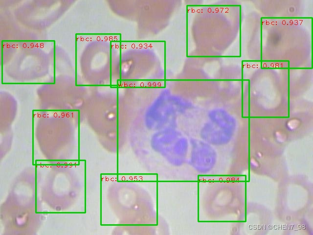 Faster R Cnn Pytorch源码血细胞检测实战（详细版）pytorch Faster Rcnn Csdn博客