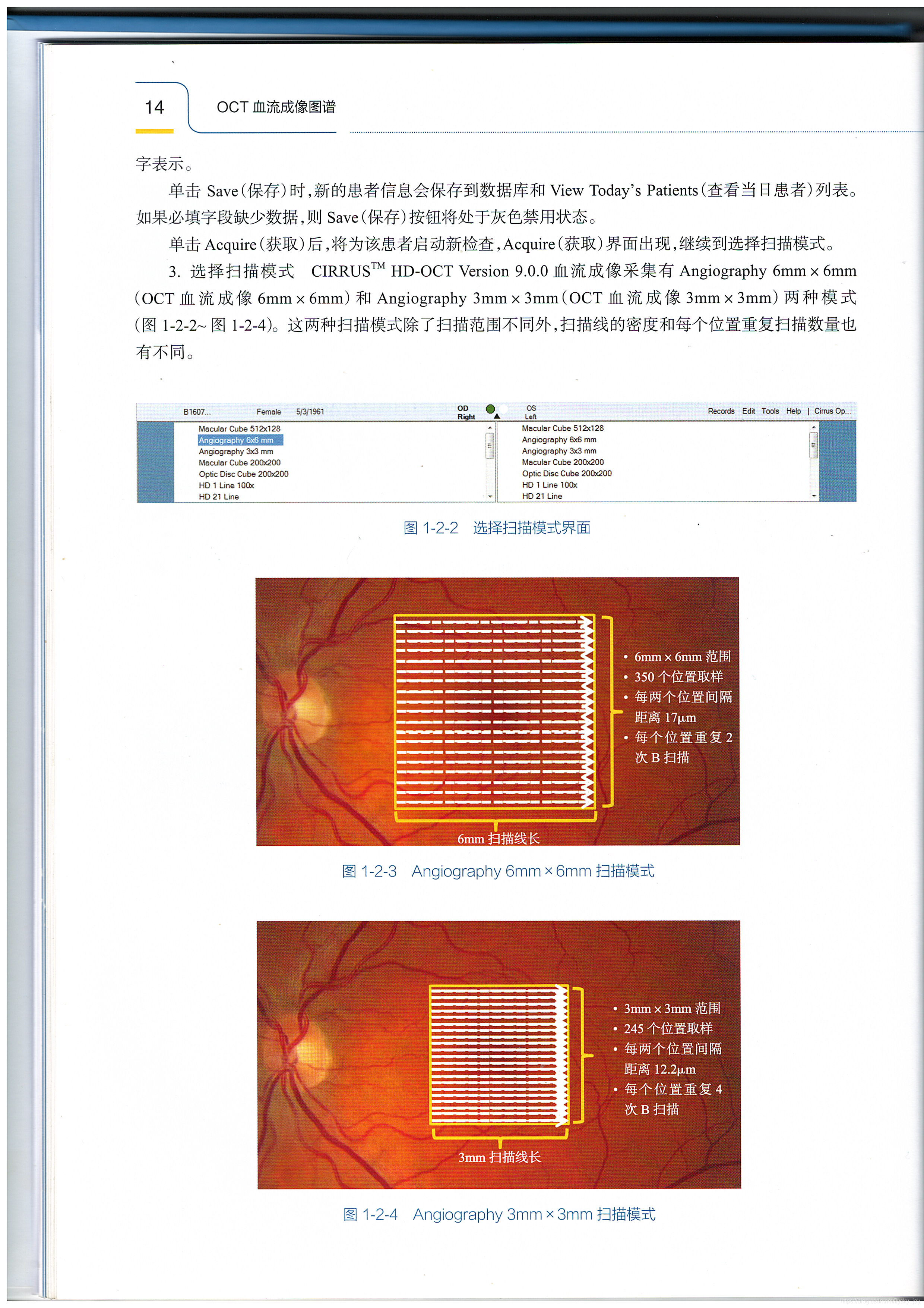 【医学图像处理】关于OCT（Optical Coherence Tomography ）的介绍_Jaborie203-魔乐社区