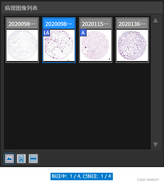 MISAT医学图像分割与标注软件套装专业版正式上线-CSDN博客