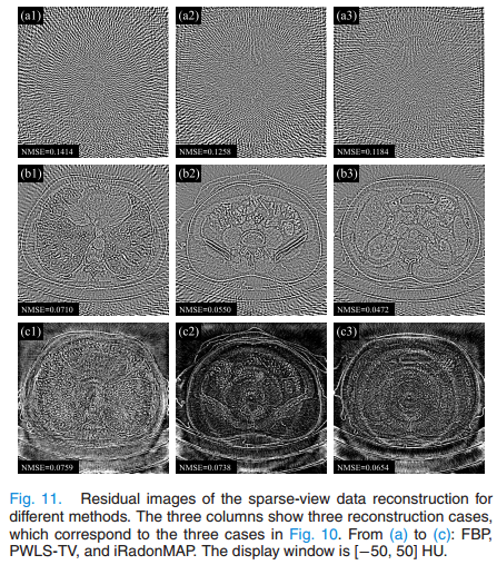 Radon Inversion via Deep Learning_iradonmap-CSDN博客
