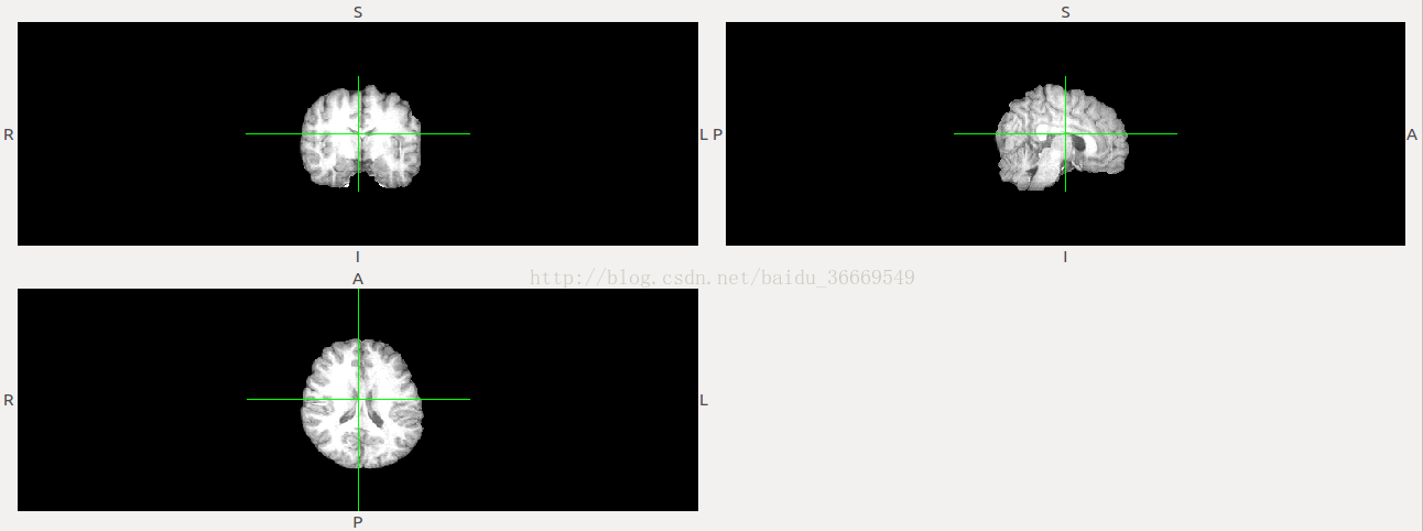 FSL脑图像处理教程-CSDN博客