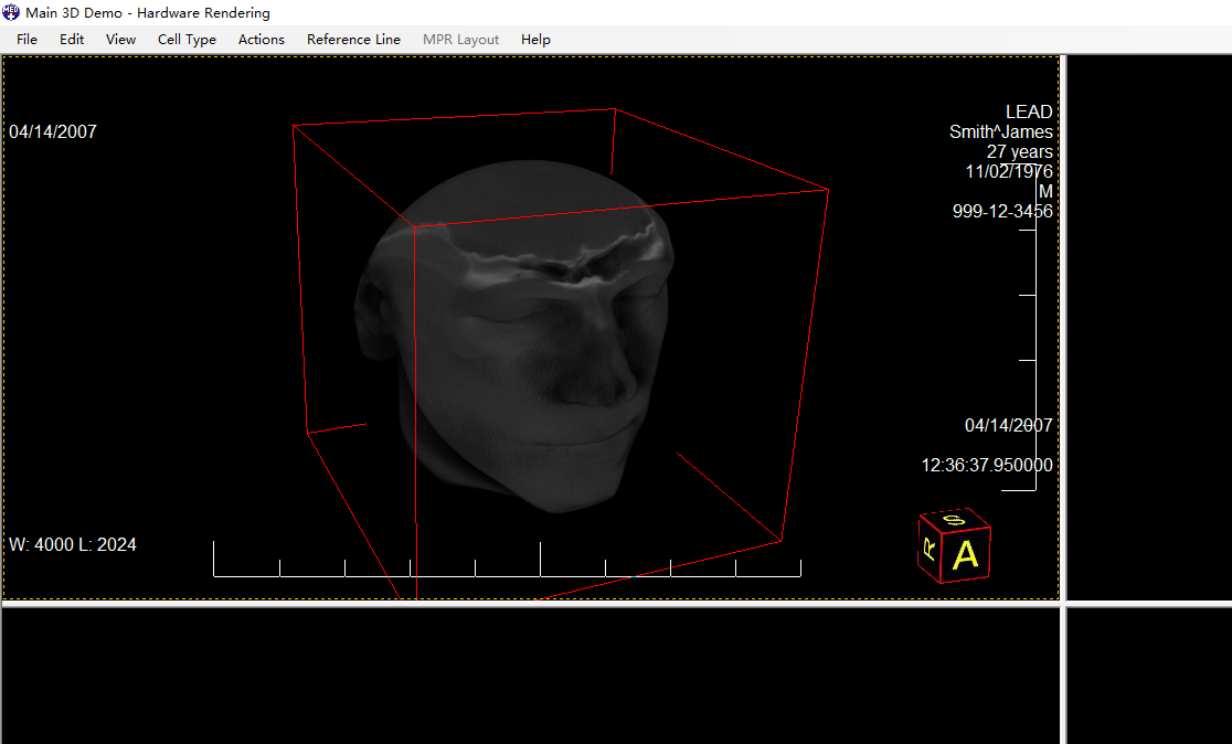 LEADTOOLS 22 套件 LEADTOOLS 超级套_leadtools 22 downalod-CSDN博客
