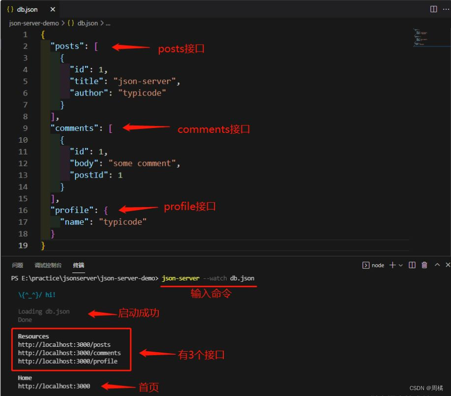 『前端必备』本地数据接口—json-server 详细介绍（入门篇）-CSDN博客