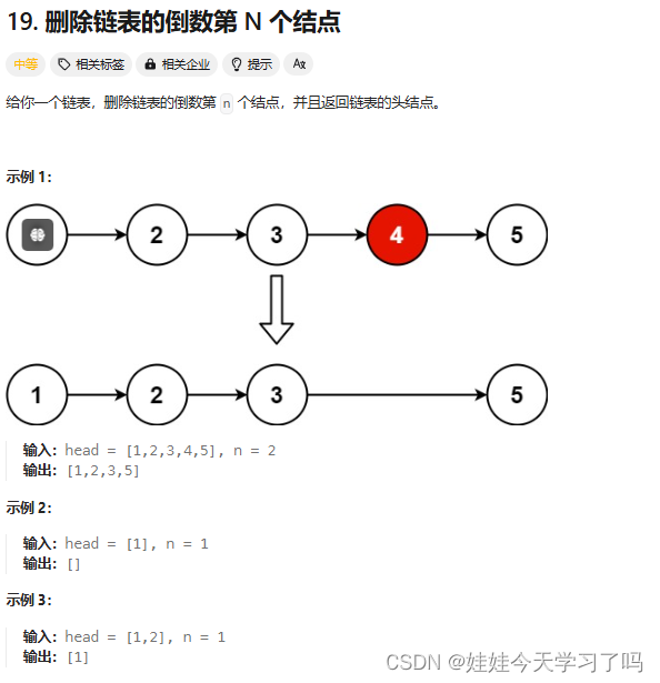 Leetcode 做题记录 19 删除链表的倒数第n个节点 Csdn博客