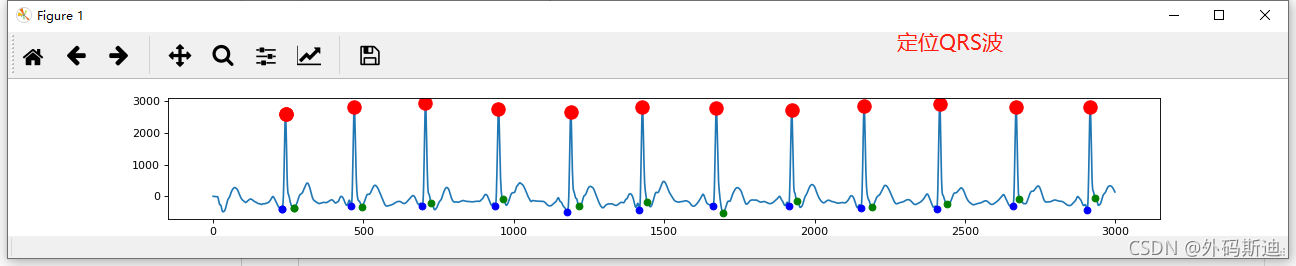 ECG信号滤波及计算心率_ecg滤波-CSDN博客