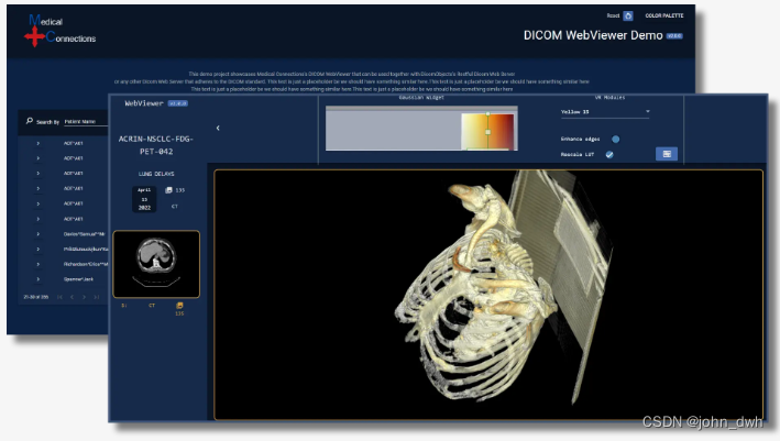 DicomObjects COM 2022-10-18-x86版本使用XP-WIN11_dicomobjects 影像组件-CSDN博客