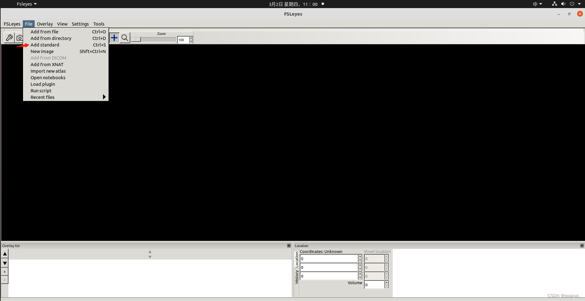 【Medical Image】MRI结构像自定义脑部ROI-基于FSL_mrview mrtrix 绘制roi-CSDN博客