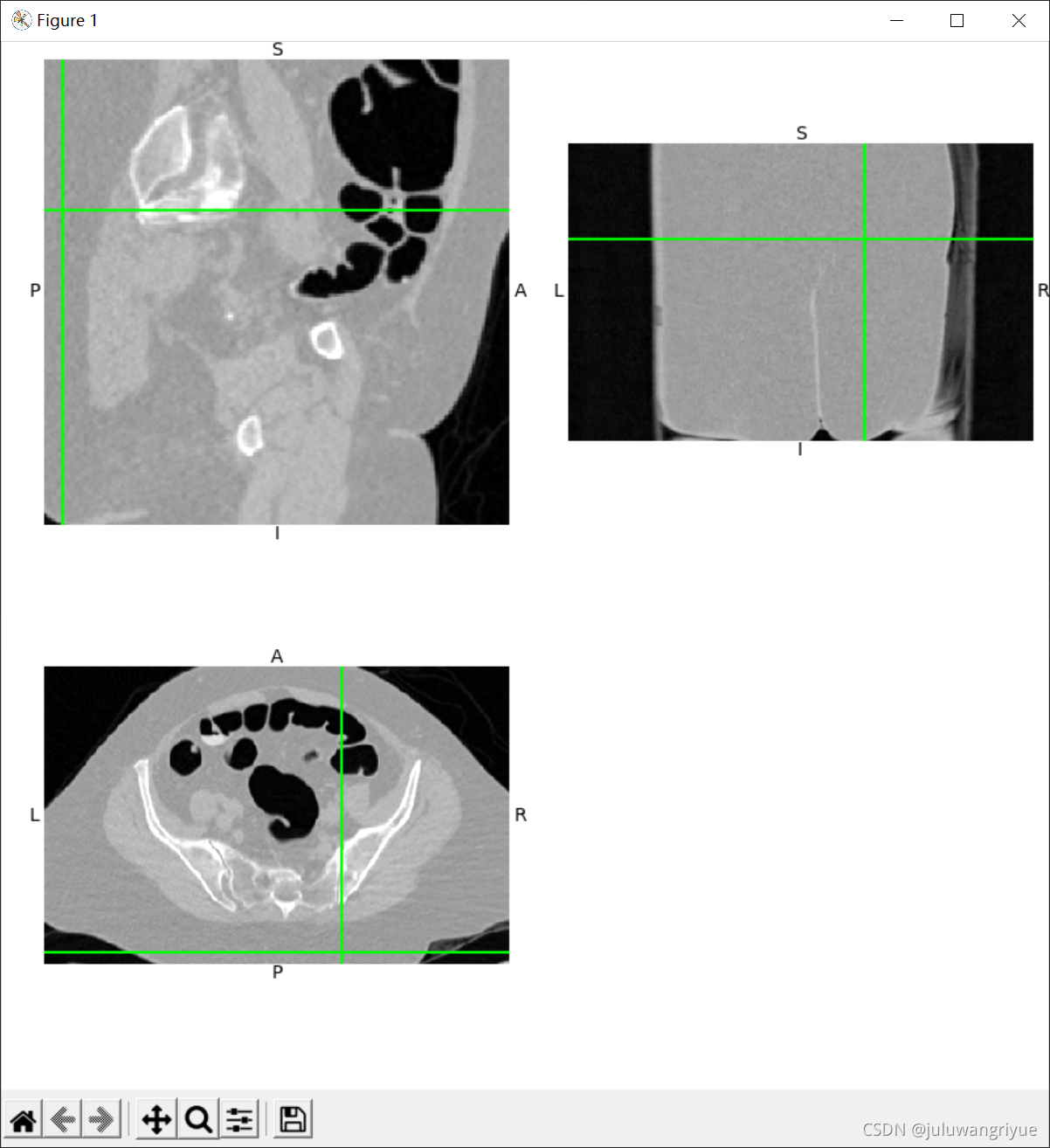 医学图像笔记（三）NIFTI数据格式-CSDN博客