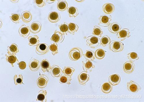医学图像处理之python Opencv实用范例源码细胞计数python Csdn博客