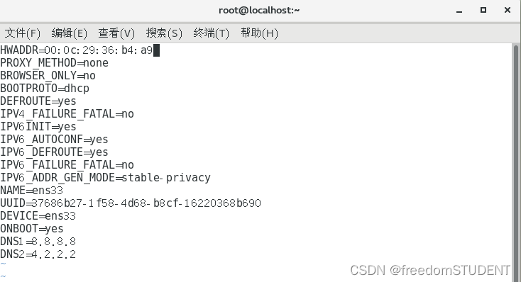 【Linux】Job for network.service failed(网卡启动报错）_linux重启网卡失败 failed-CSDN博客