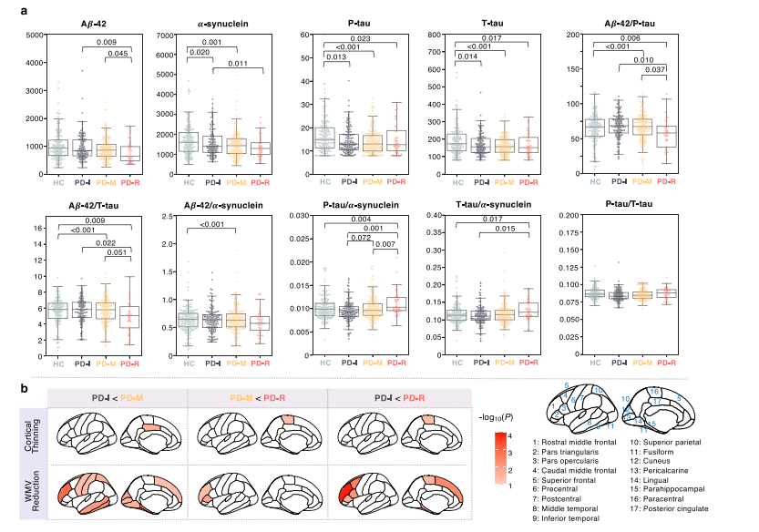通过多模态数据综合分析识别帕金森病PACE亚型并重新利用治疗方法| 文献-基于人工智能(AI base)的医学影像研究与疾病诊断_ppmi数据集-CSDN博客
