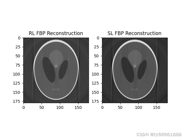 python实现Sheep-Logan头模型直接反投影，R-L函数滤波反投影重建算法和S-L函数滤波反投影重建算法_shepplogan滤波器-CSDN博客