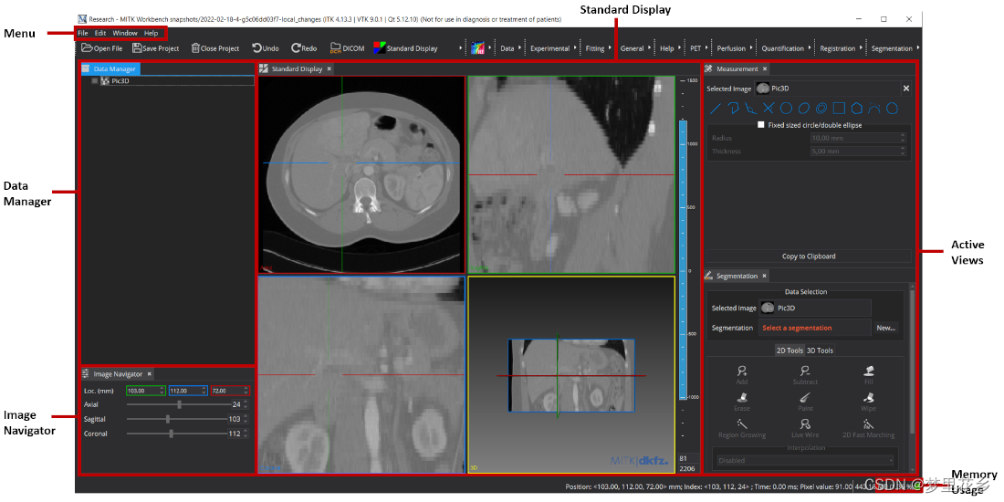 VS2022联合Qt5开发学习7（QT5.12.3联合VTK在VS2022上开发医学图像项目2——十字叉标注）_qt vs开发-CSDN博客