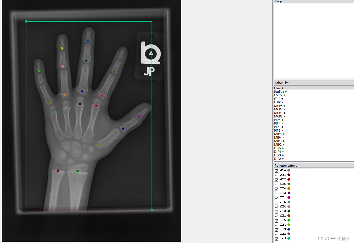 Yolov13 Pose关键点检测：训练实战手把手教程篇 自己数据集从labelme标注到生成yolo格式的关键点数据以及训练教程yolov13 Pose Csdn博客