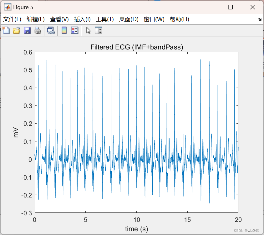通过EEMD进行心脏频率和心电图信号去噪（Matlab代码实现）_基于emd的心电图去噪数字滤波方法研究-CSDN博客