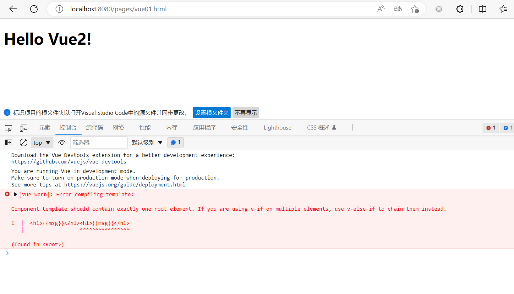 Vue2_01_data_插值_vue的插值语法获取data-CSDN博客