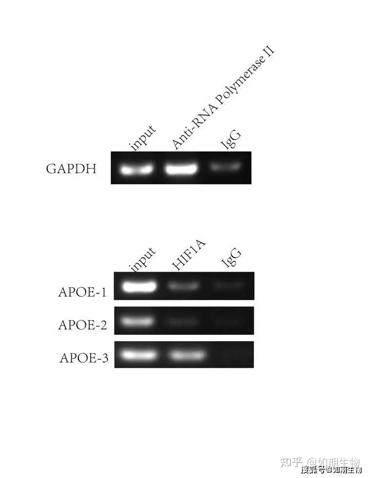 RIP实验方法及检测报告模板_rip试验异丙醇rna沉降要多久完成-CSDN博客