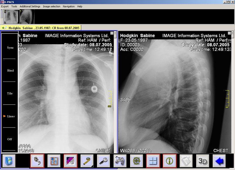 【转】DICOM开发工具总结_dvtk dicom validation tool-CSDN博客