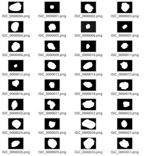 ISIC Archive数据集下载_isic数据集下载-CSDN博客