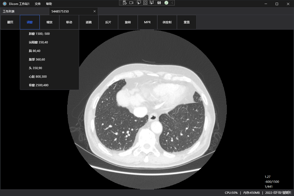 C# 实现医学影像 DICOM 工作站(1):项目介绍_c# dicom-CSDN博客