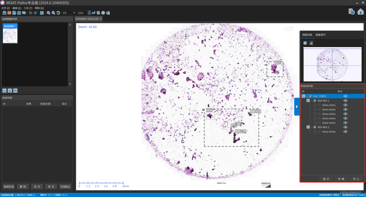 MISAT医学图像分割与标注软件套装专业版正式上线-CSDN博客