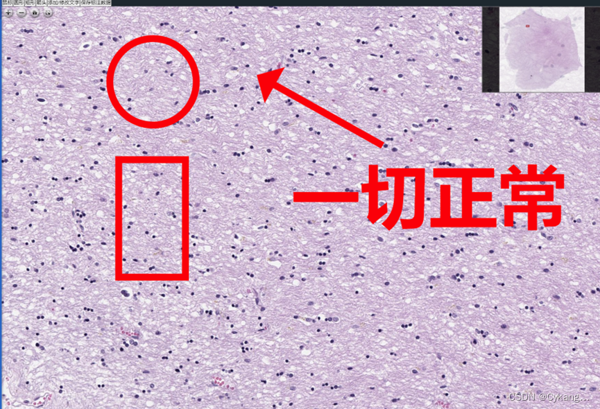 Openseadragon在Vue+SpringBoot框架下的使用（前后端衔接）_vue openseadriagon-CSDN博客