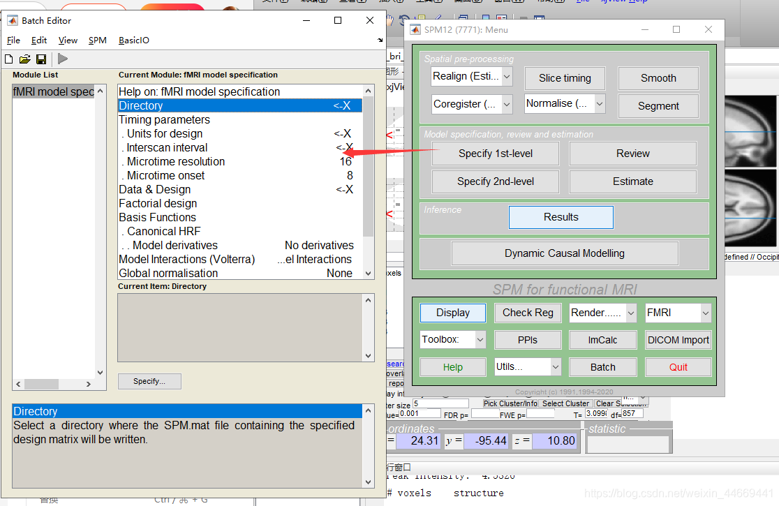 fmri|学习笔记 1st level analysis和xjview-CSDN博客