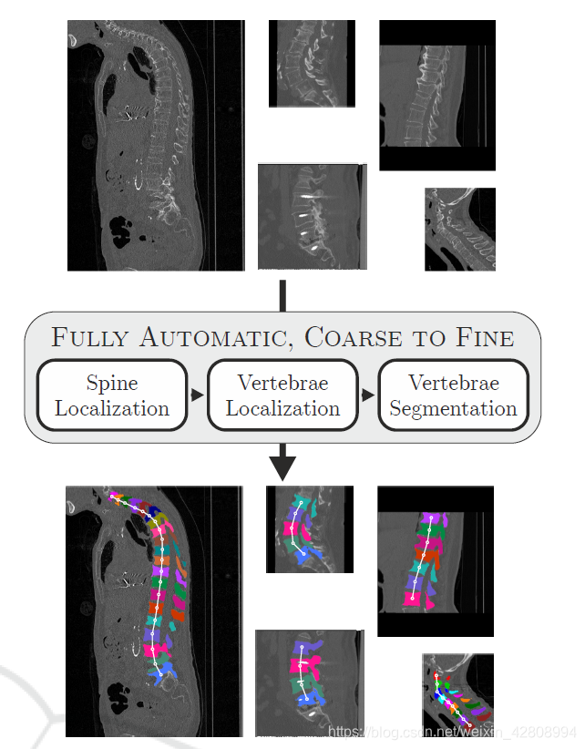 Coarse to Fine Vertebrae Localization and Segmentation论文笔记_spatialconfiguration-net-CSDN博客