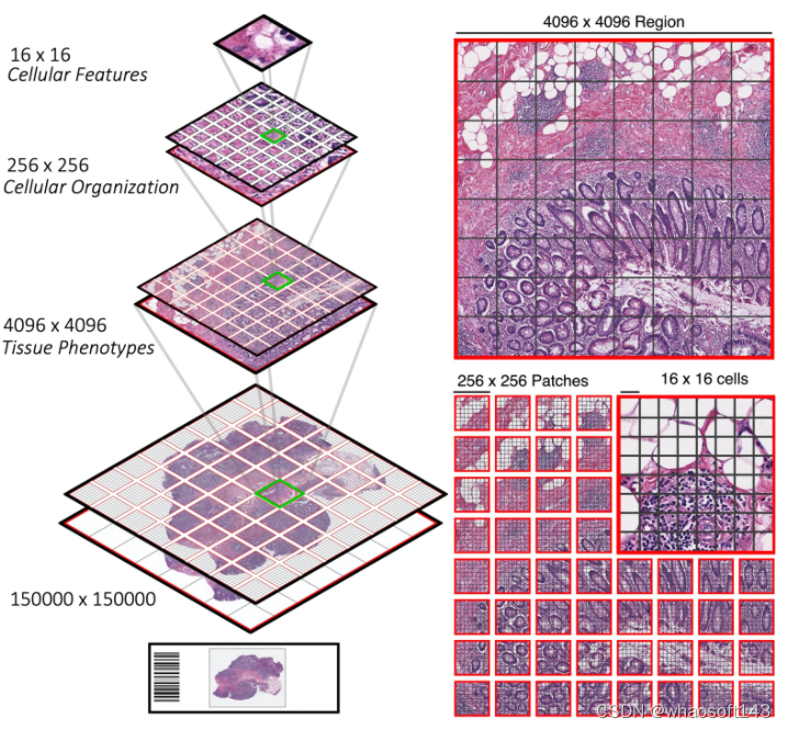 ViT~6_tcga 组织病理全玻片wsi-CSDN博客