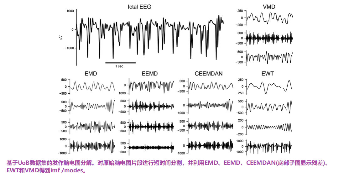 【文献翻译】Evaluating five different adaptive decomposition methods for EEG signal seizure detection ...
