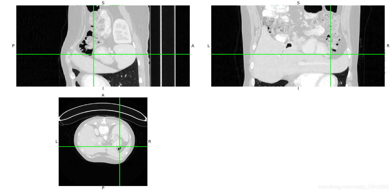 【5】nibabel三维显示_orthoslicer3d(data.transpose(1, 2, 0)).show()-CSDN博客