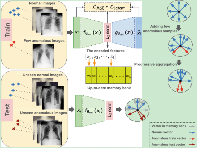 MICCAI2020 (AD)-解读《SALAD: Self-supervised Aggregation Learning for Anomaly Detection on X-Rays ...