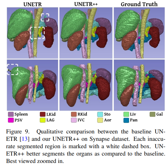 超越nnFormer！UNETR++：高效准确的3D医学图像分割_unetr++: delving into efficient and accurate 3d me-CSDN博客