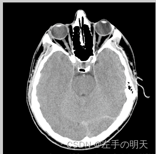 【Matlab函数分析】imread从图形文件读取图像-CSDN博客