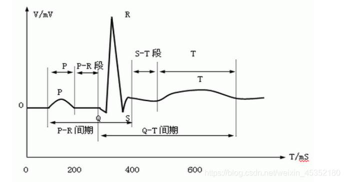 Matlab心电信号QRS波检测_知道qrs峰值点这么求q波-CSDN博客