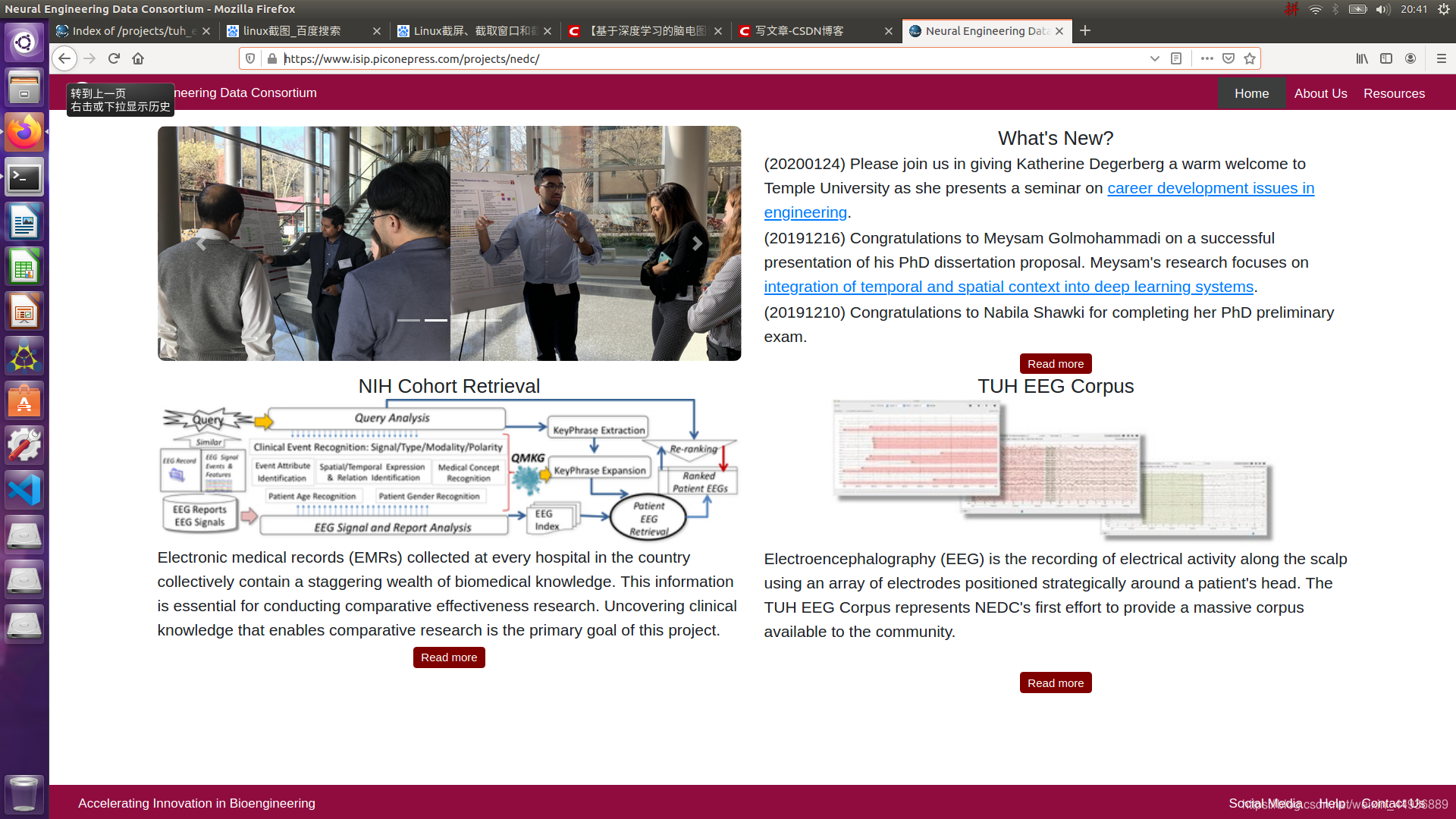 【基于深度学习的脑电图识别】TUH EEG 脑电图数据下载方法_复旦大学 脑电图数据集下载-CSDN博客